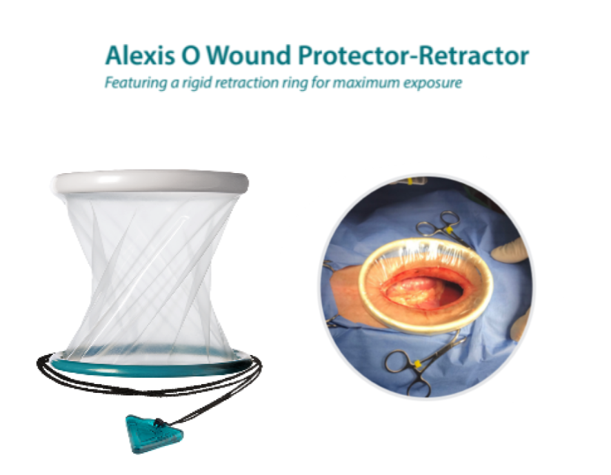 Alexis O Wound Protector Retractor – Applied Medical